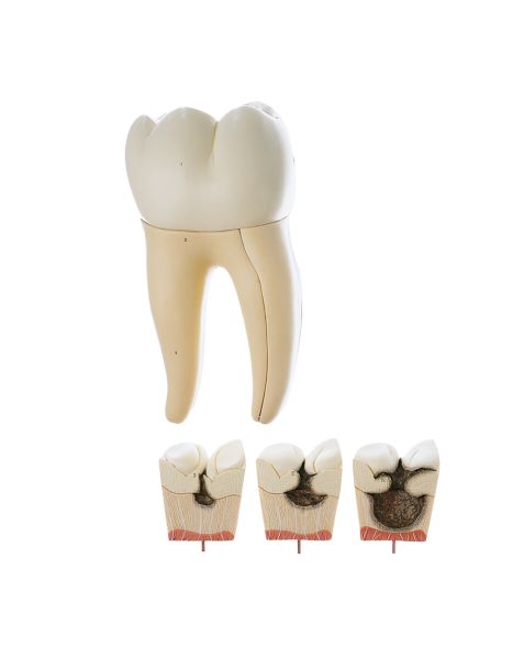 Right Lower First Molar | Enlarged Tooth Models | Oral Cavity | Head ...
