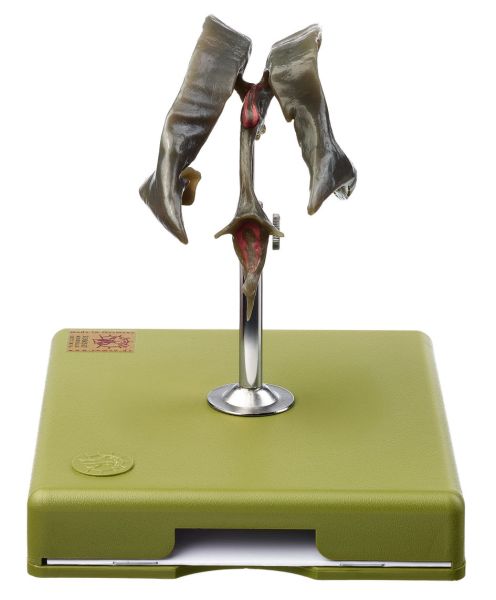 Ventricular Cavities of the Brain | Ventricular Cavities of the Brain ...