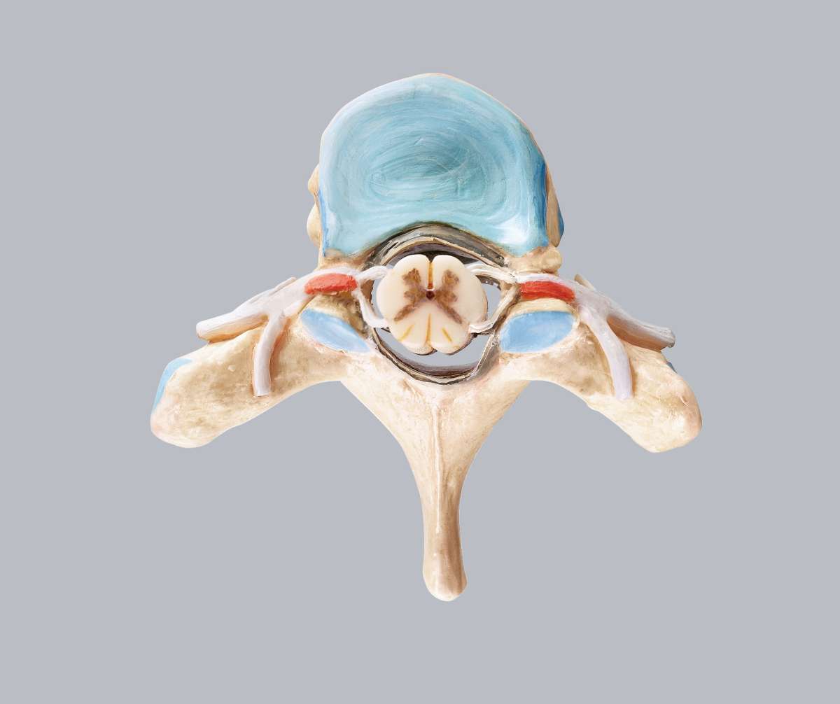 Thoracic Vertebra (TH II) with Spinal Cord | Vertebra with Spinal Cord ...