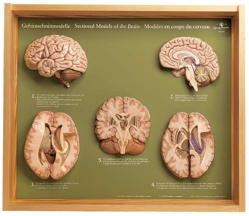 5 Gehirnschnittmodelle | Schnittmodelle | Gehirn / Rückenmark ...